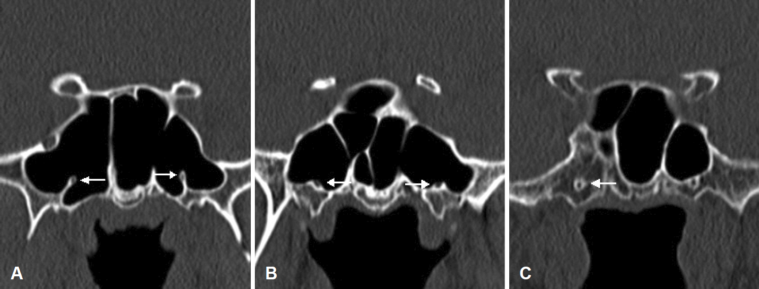 :: Korean Journal of Otorhinolaryngology-Head and Neck Surgery